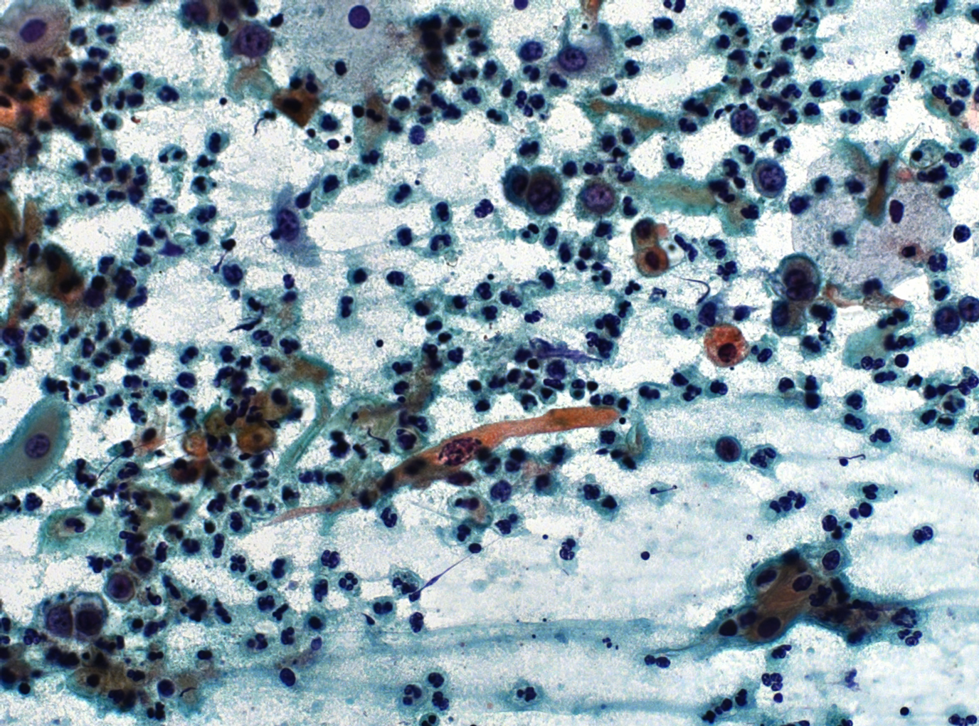 Cervical Cancer 400 Image Cric Object Detection Dataset by Lab 03 AI Center