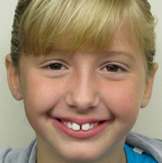 Teeth Object Detection Dataset by alpha