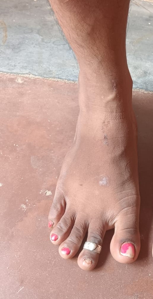 How to Use the Foot_detection_cropped_images Object Detection API