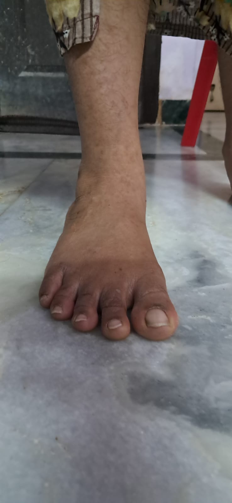Foot Detection Cropped Images Object Detection Dataset By Ulcer Detection