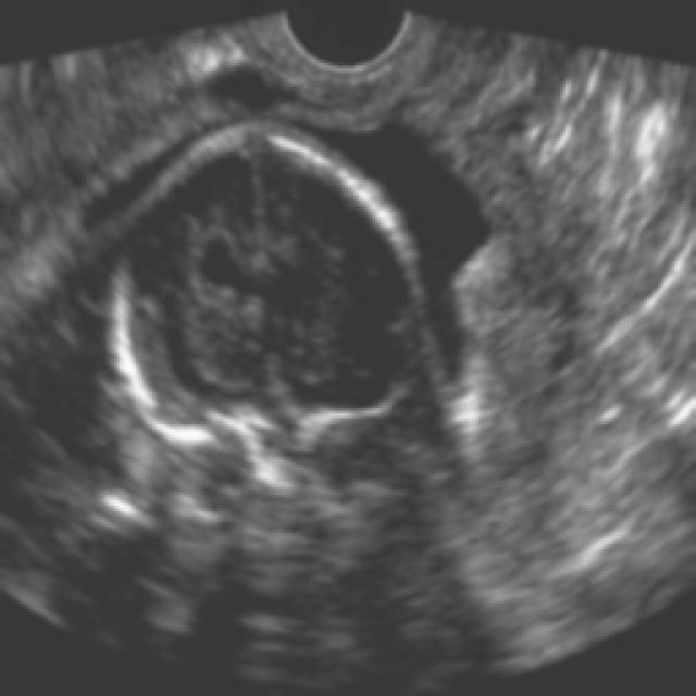 segmentation and detection Instance Segmentation Model by Final Yeat