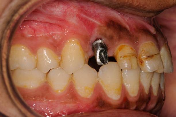 tooth Object Detection Dataset by d7i