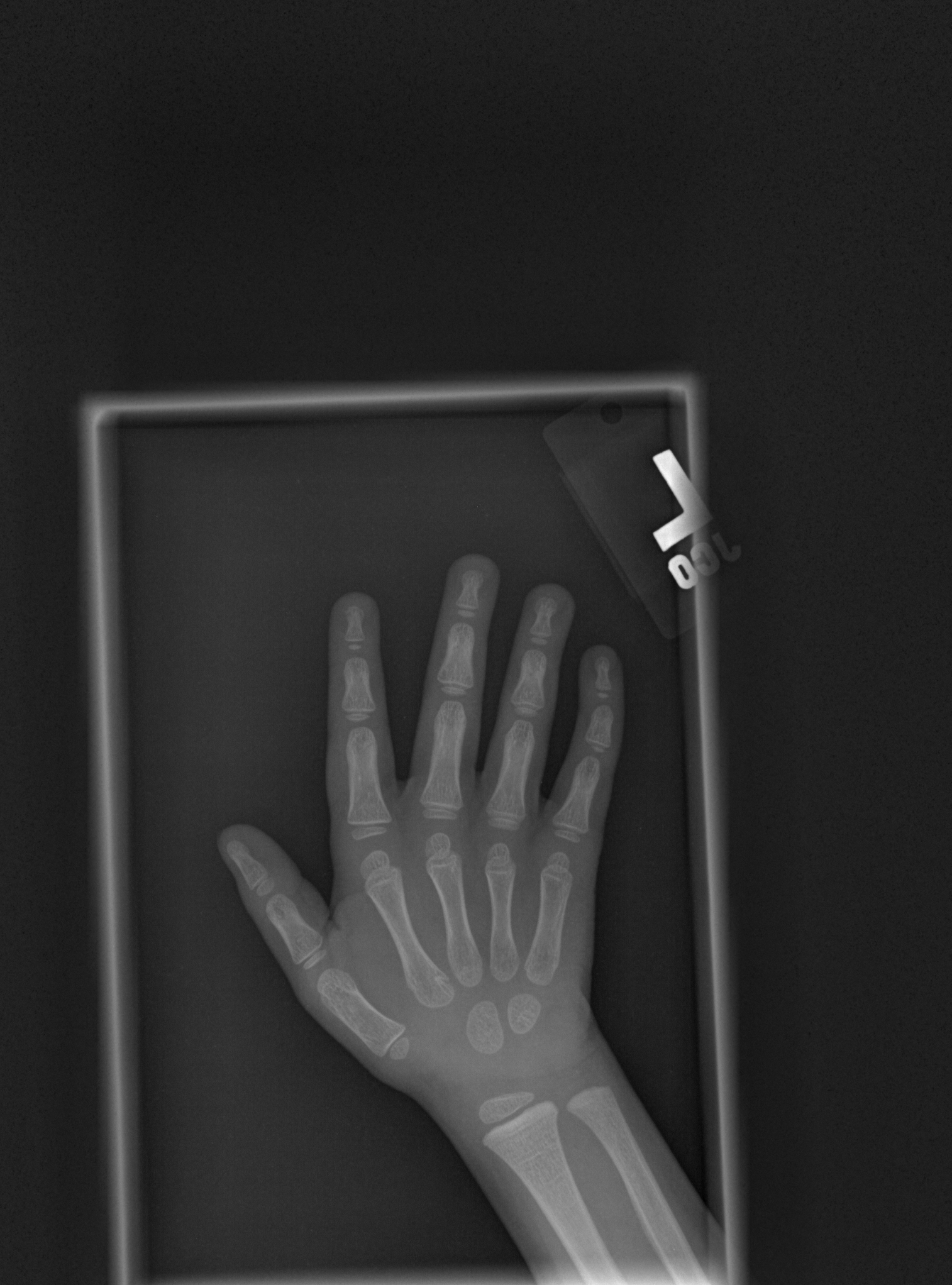 Yolov5 Object Detection Dataset And Pre Trained Model By Scamp