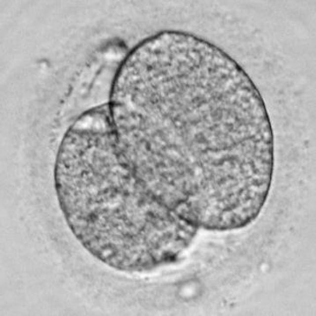 oocyte Analysis 4 Object Detection Dataset by 360digitmg
