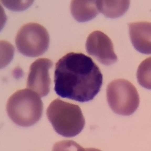 Eosinophil Object Detection Dataset by shool