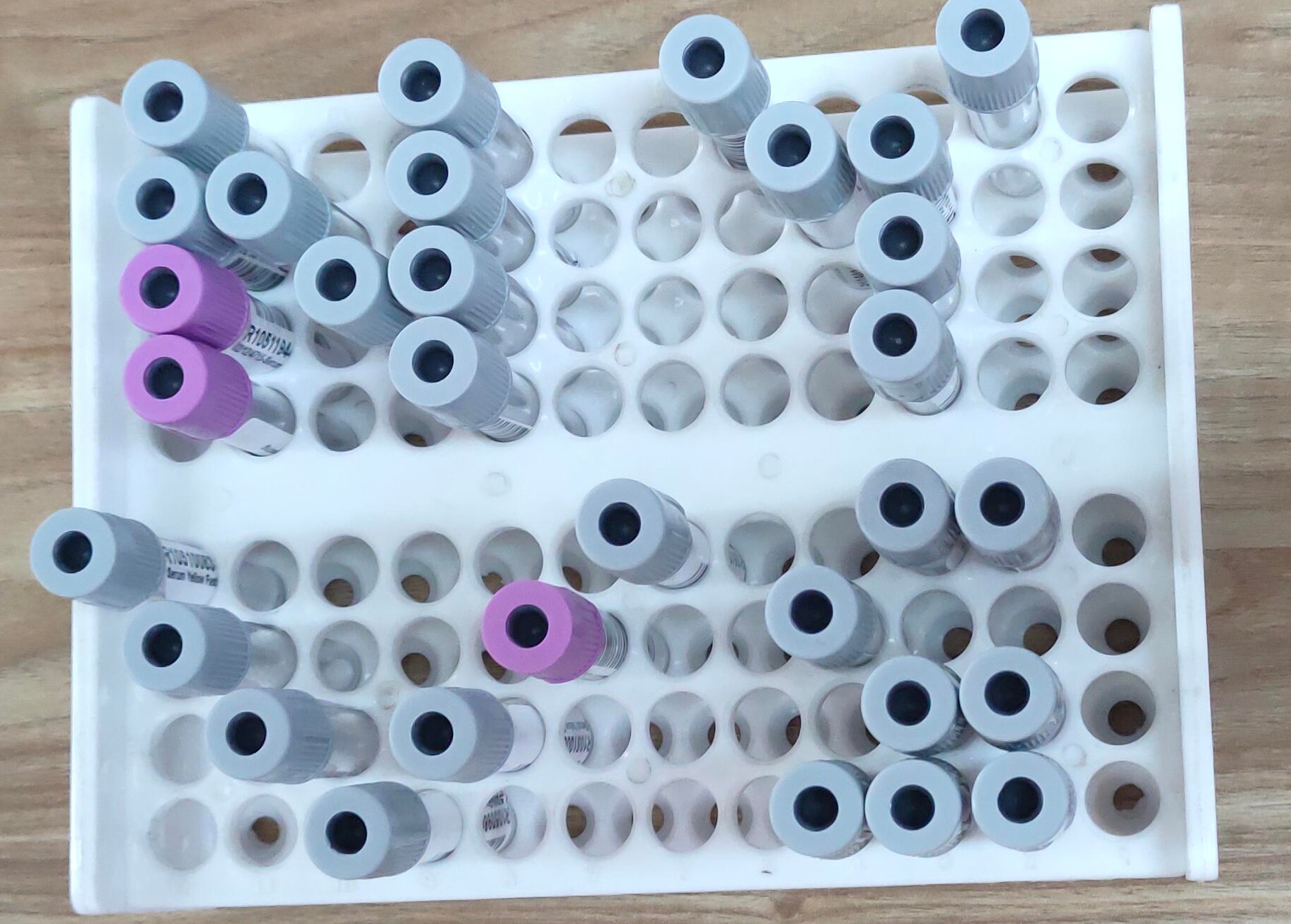 Tube Detection Object Detection Dataset By Delta Parallel Robot