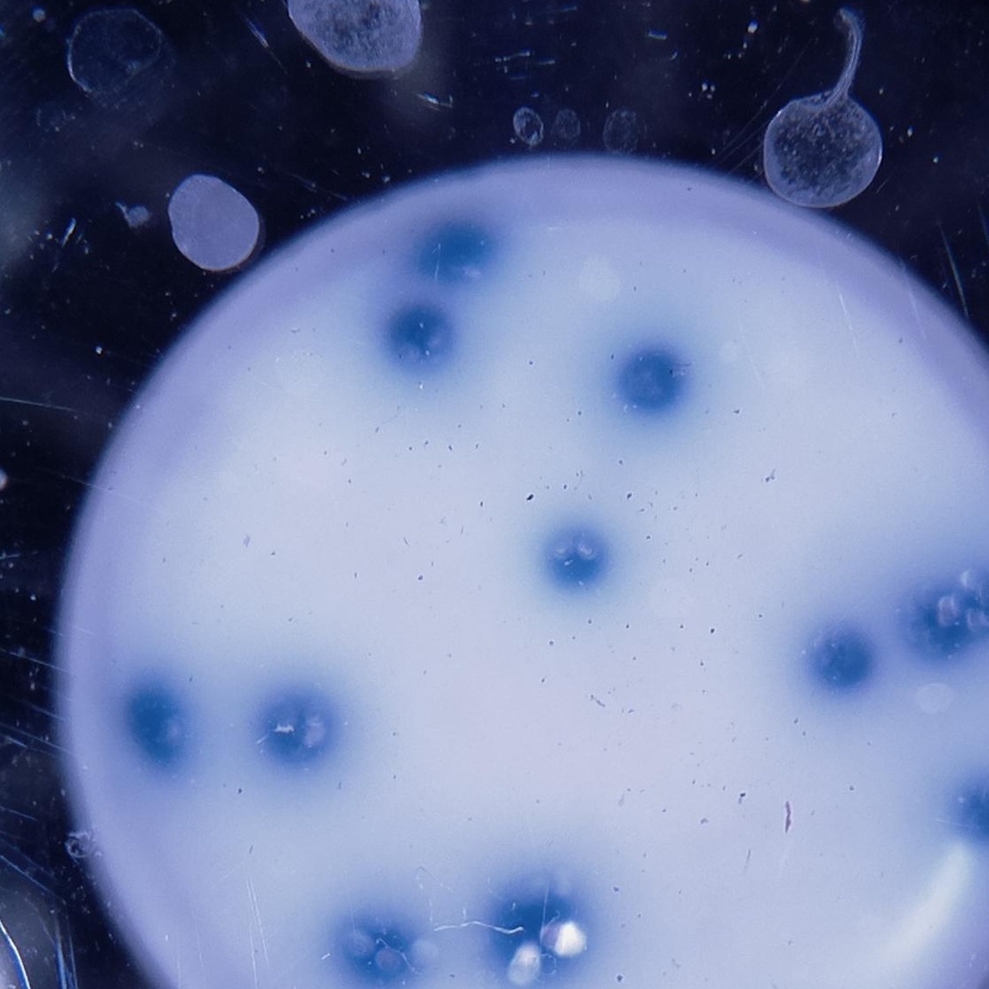 Delta Parallel Robot Obstacle Avoidance Project - Roboflow Universe