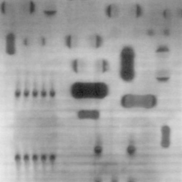 SMT-Res Detection Object Detection Dataset and Pre-Trained Model by FYP