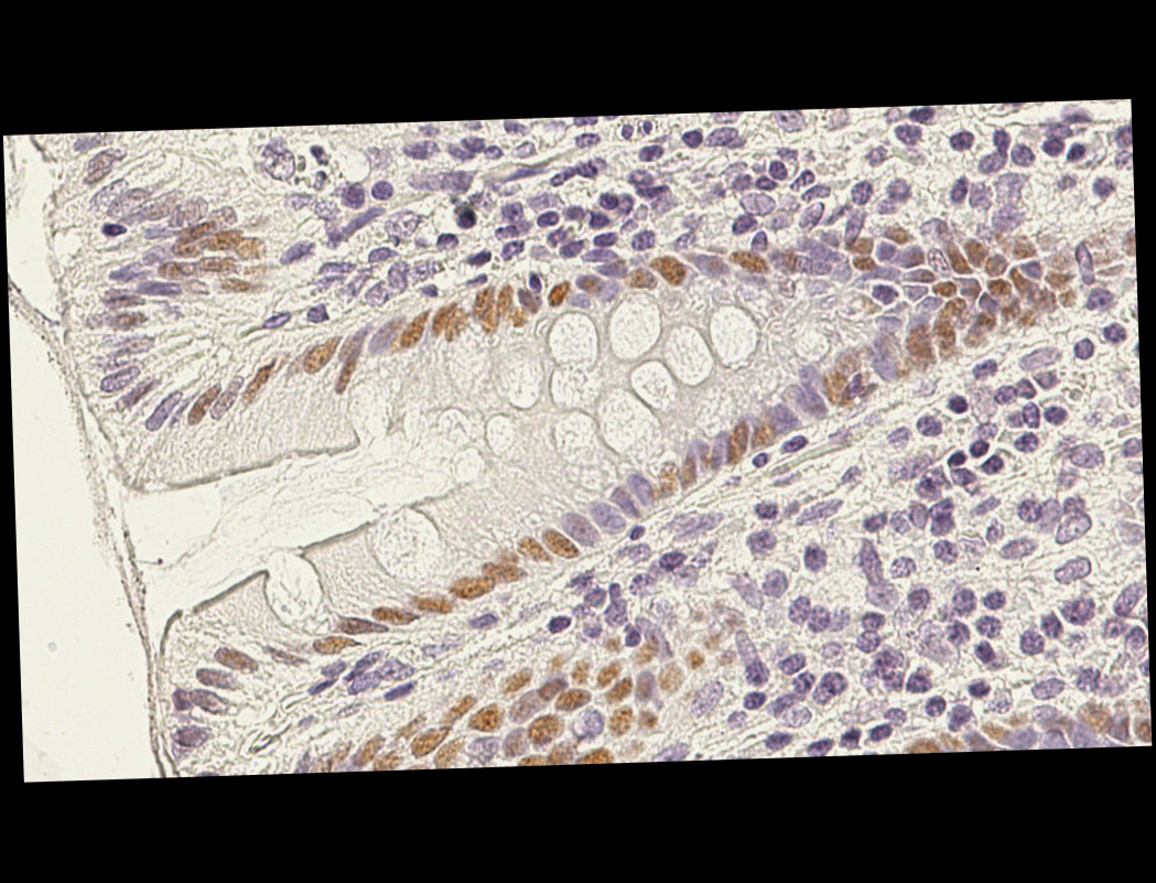 Crypt_Segmentation Semantic Segmentation Model by BooleanLab