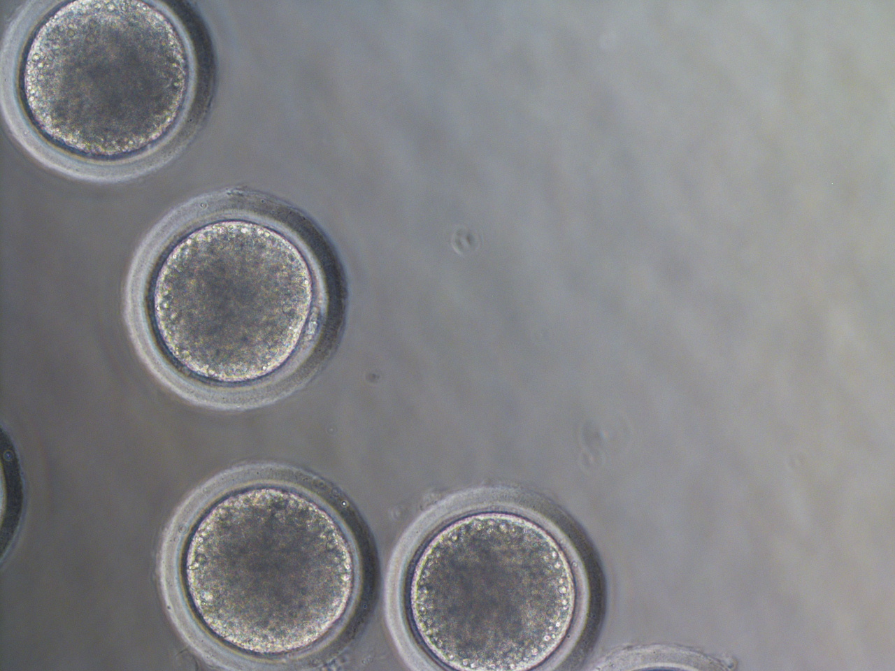 Egg segmentation-Zona Instance Segmentation Dataset by My workspace