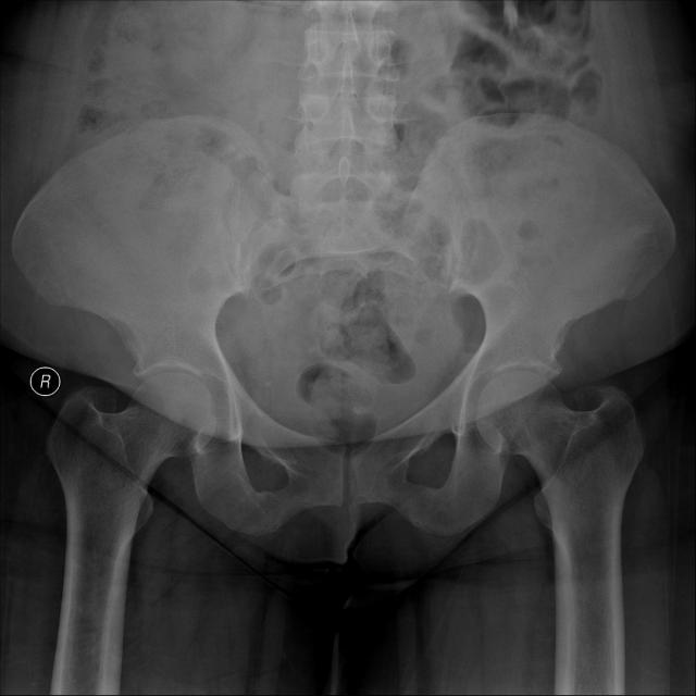 instance segment test Instance Segmentation Dataset and Pre-Trained ...