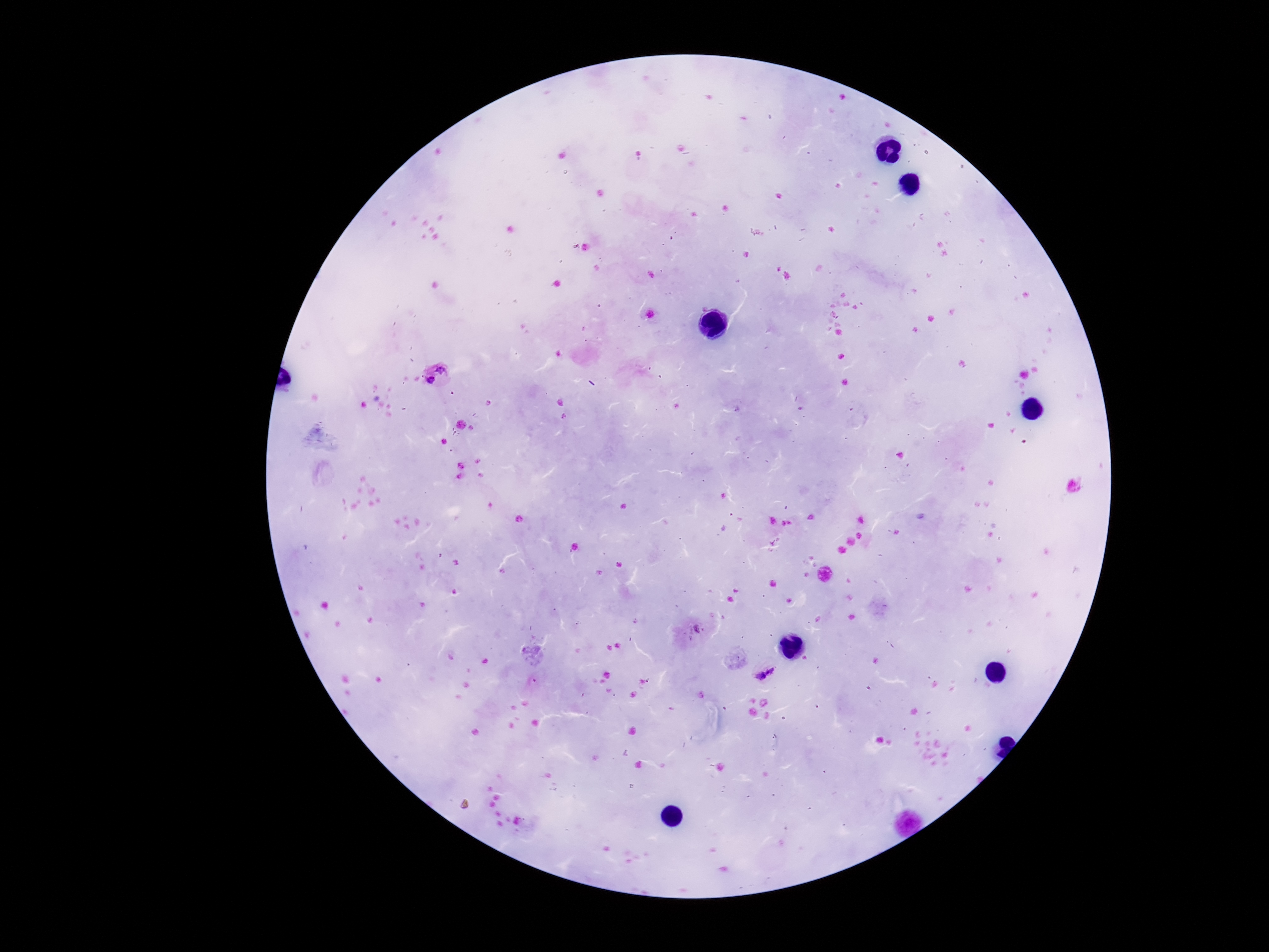 Malaria Object Detection Dataset By Malaria Fold1