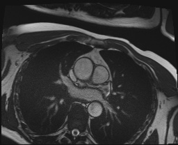 detection BBox Object Detection Dataset by aortes