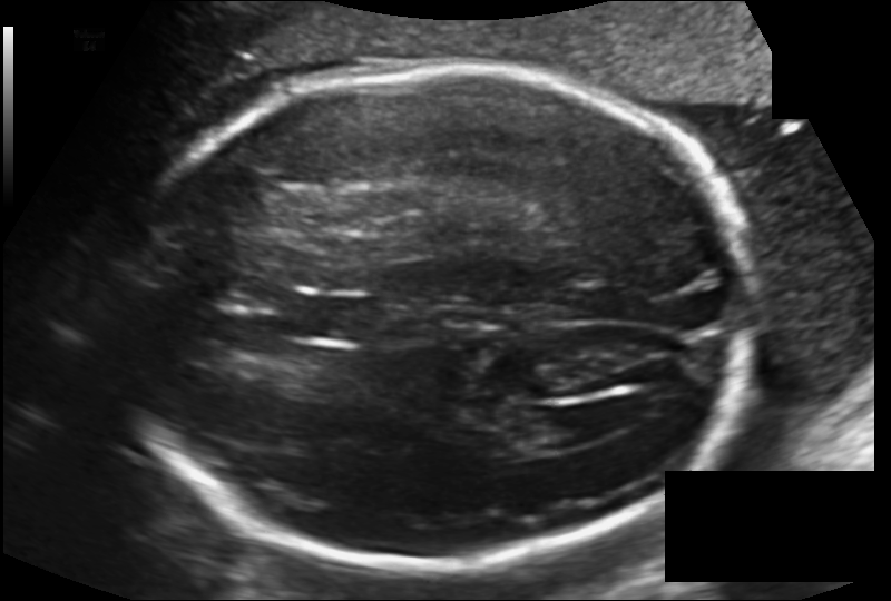 Medical_seg Instance Segmentation Dataset by Jiangnan university