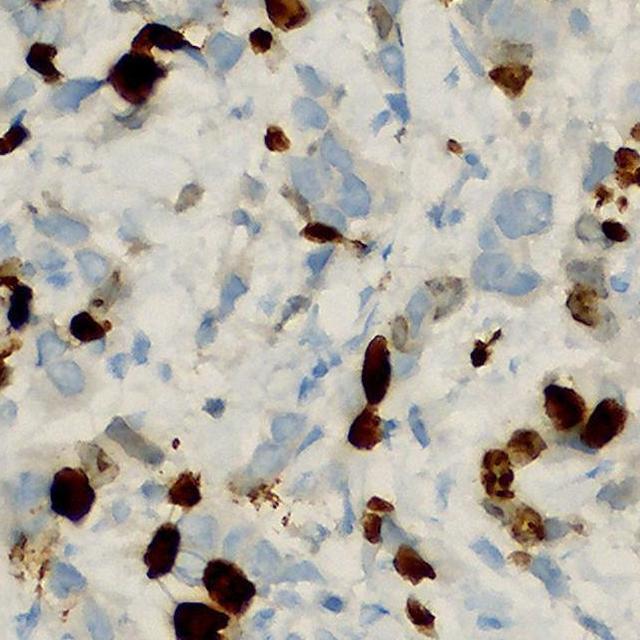 Ki67-v2 Object Detection Dataset and Pre-Trained Model by Ki67