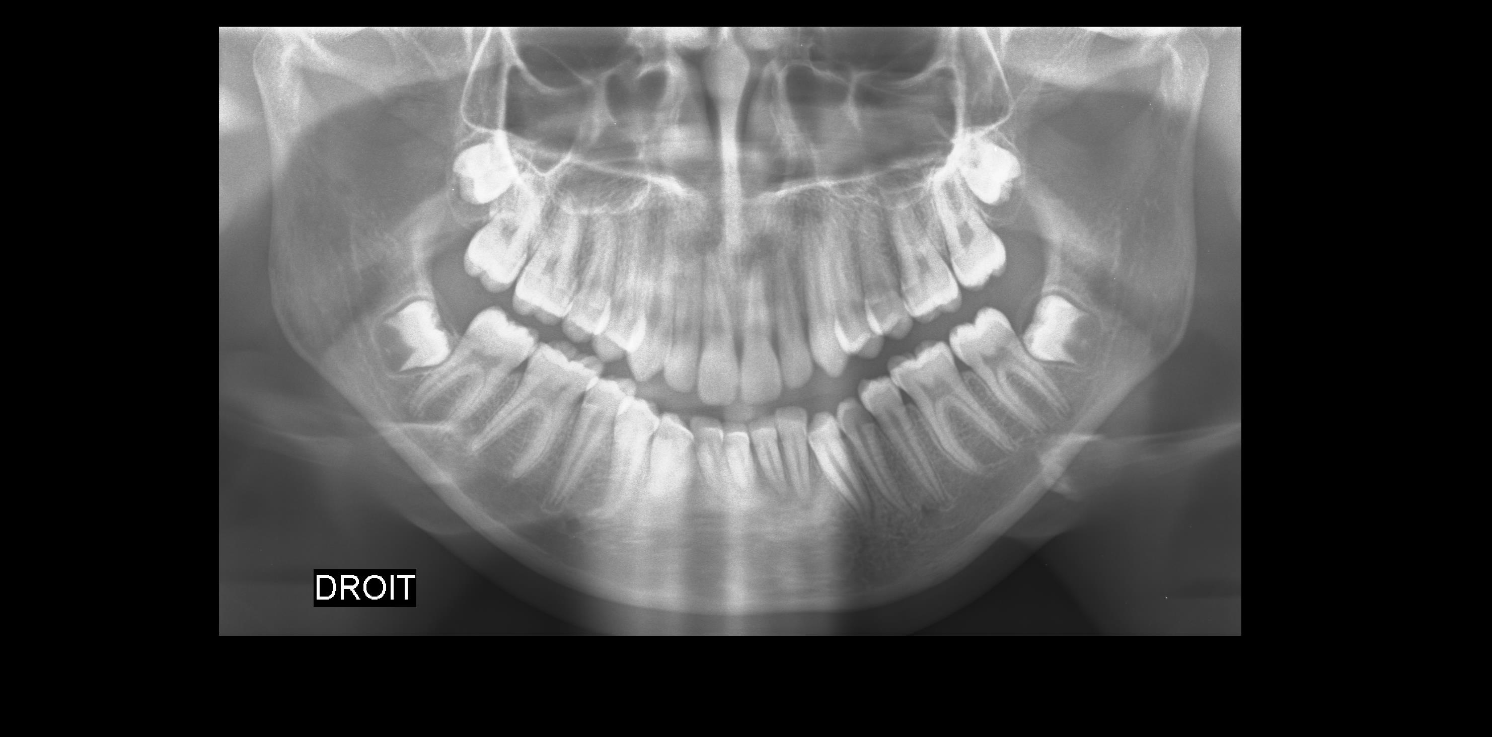 Project 1 – Large Data Set Object Detection Dataset and Pre-Trained ...