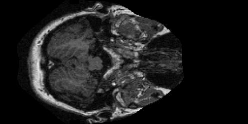 MRI Brain Instance Segmentation Model by 1Oct