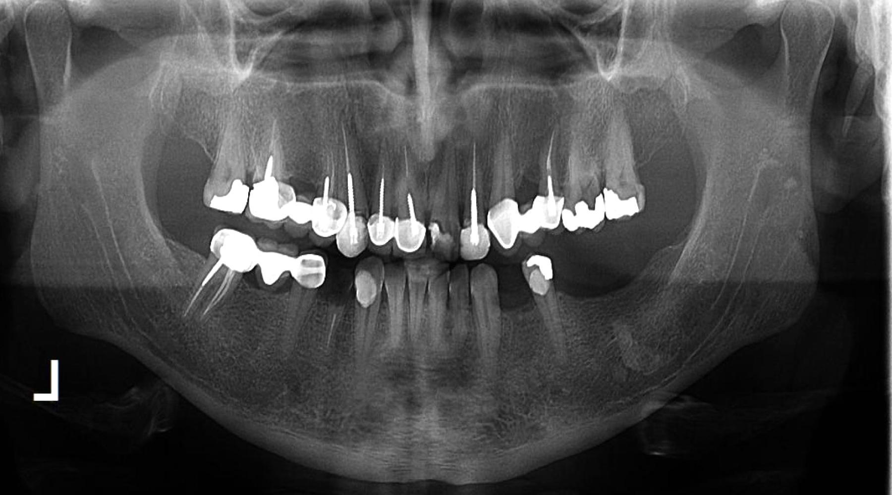 segmentation sn Instance Segmentation Model by plan of pablic
