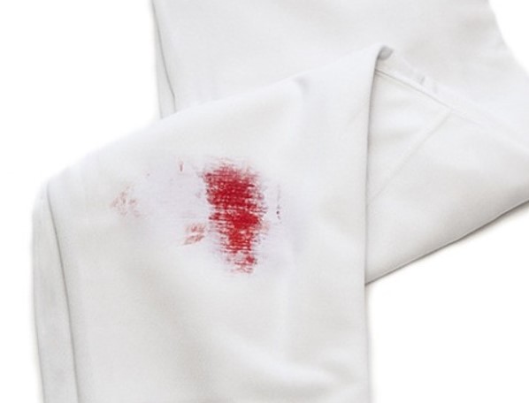 fabric defects Object Detection Dataset by Asia Pacific University