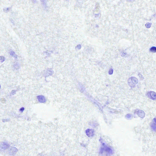 Asim Gul - Roboflow Universe