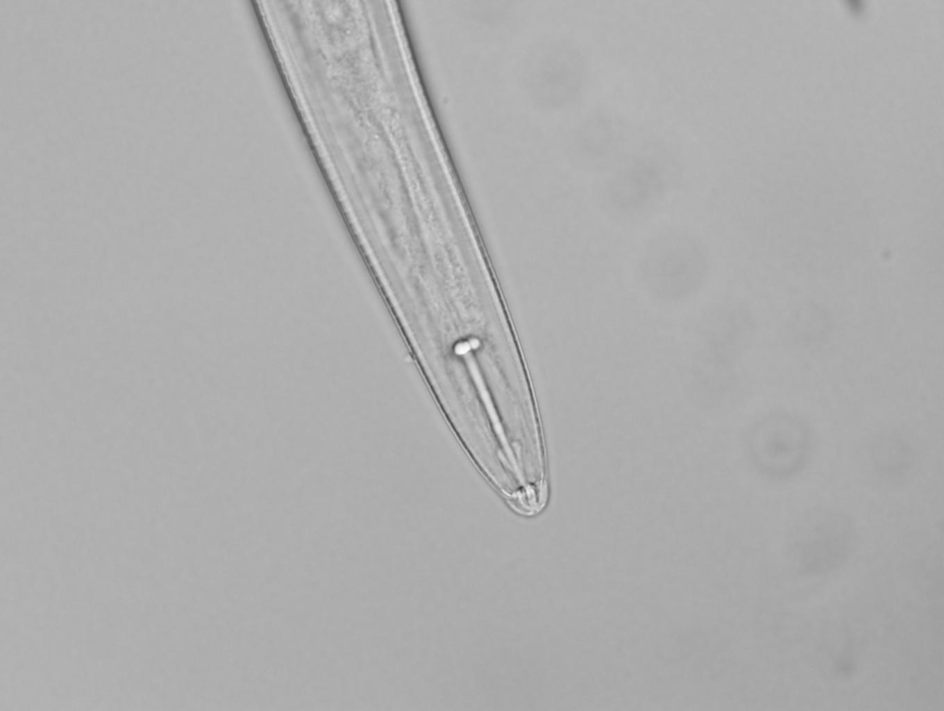 Plant Parasites - Helicotylenchus - Object Detection Model by prox mate