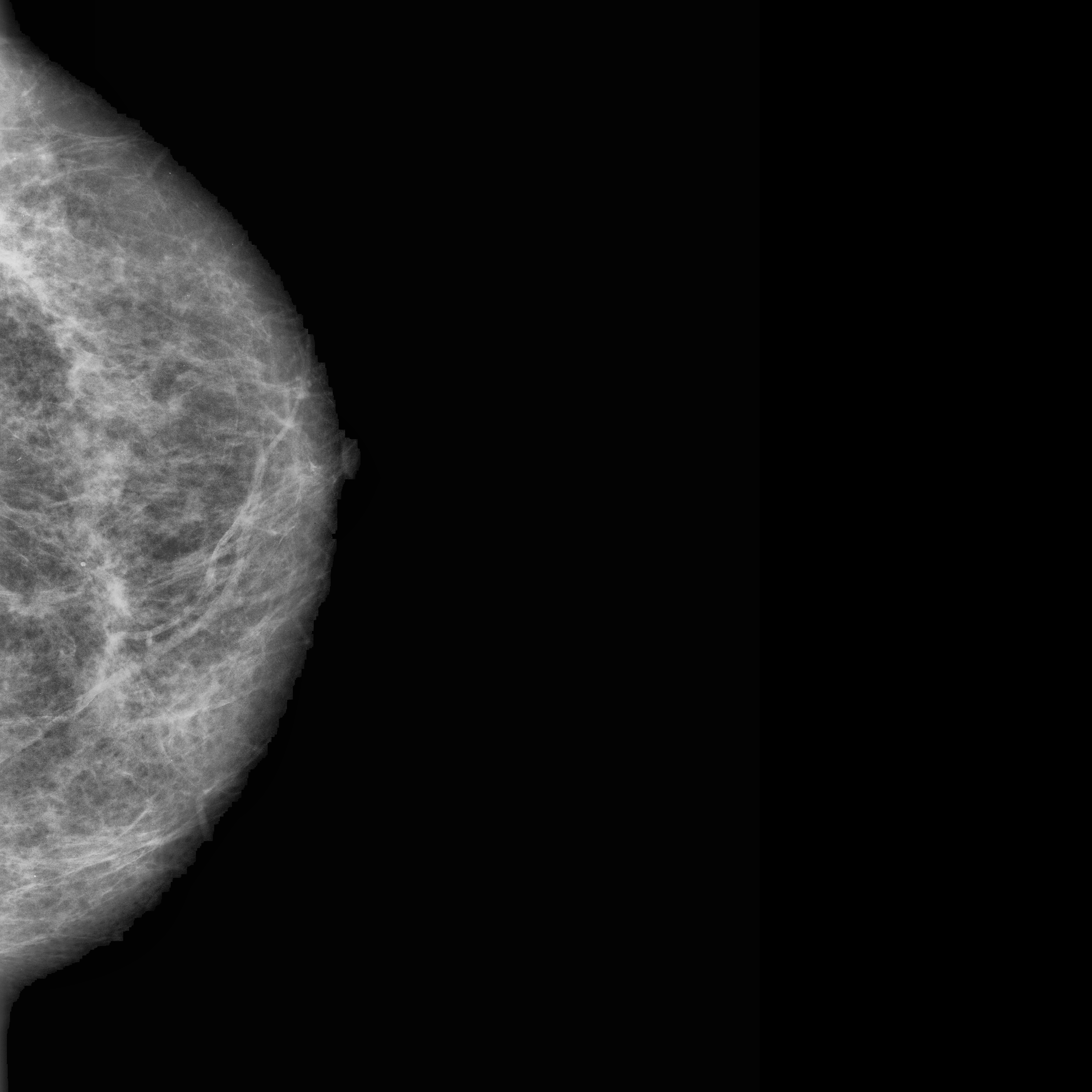 BreastCancer Instance Segmentation Dataset by Abdullah gl dataset