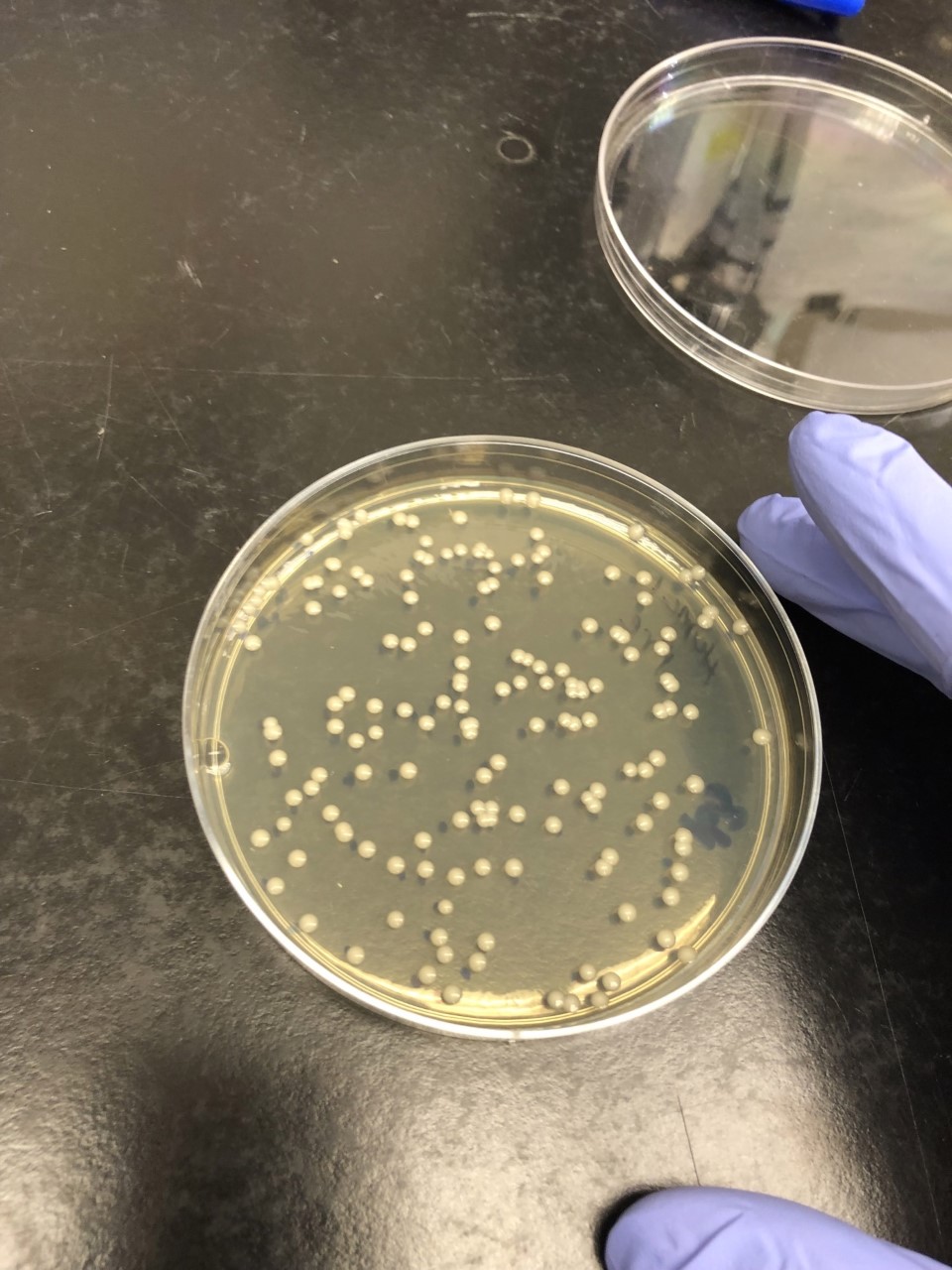CFU Inoculum Object Detection Model by Zac Builta