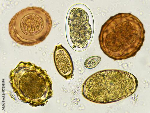 Parasites Object Detection Model by ahmad