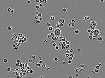 tcell_segmentation_full Instance Segmentation Dataset by thesis