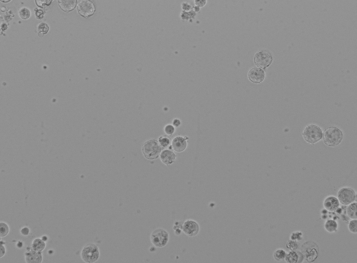 check_j Instance Segmentation Dataset by thesis