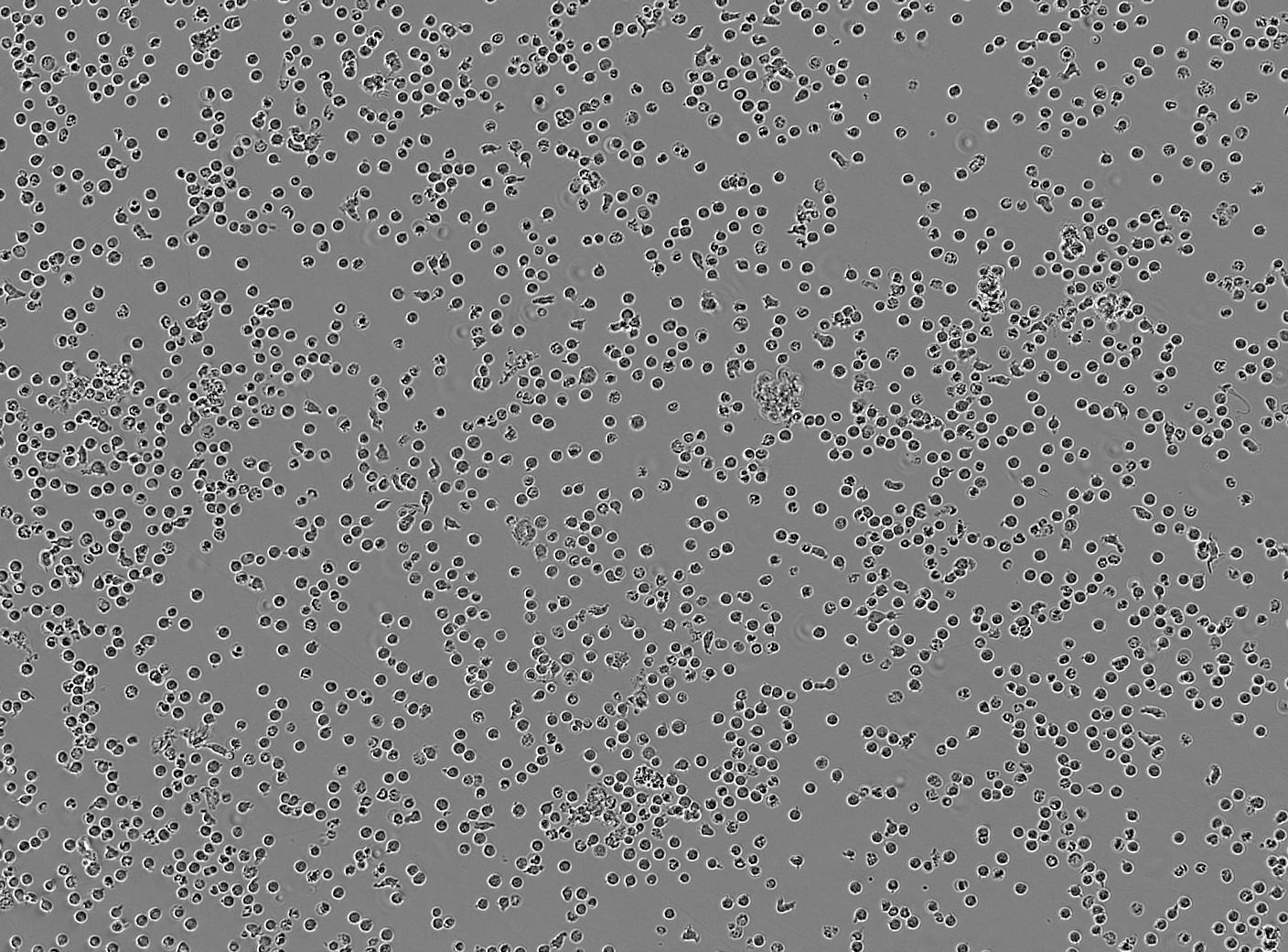 tcell_cluster_segmentation Instance Segmentation Dataset by thesis