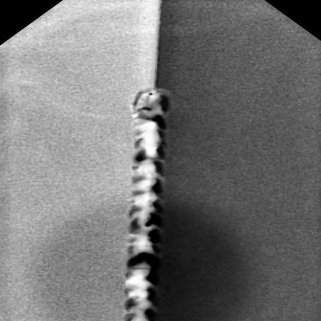 Pores Detection Instance Segmentation Model by krutin parekh