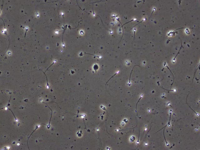 sperm Object Detection Dataset by roxy