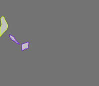 intraoral cavity detection - Roboflow Universe