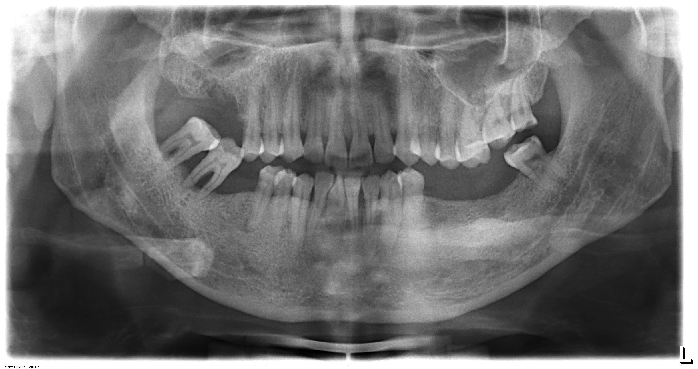 Panorama Object Detection Dataset By Hmu