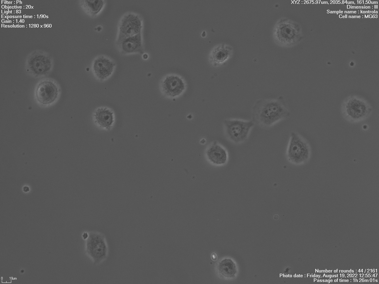 MG63 cell detection Object Detection Dataset by Aligaterr