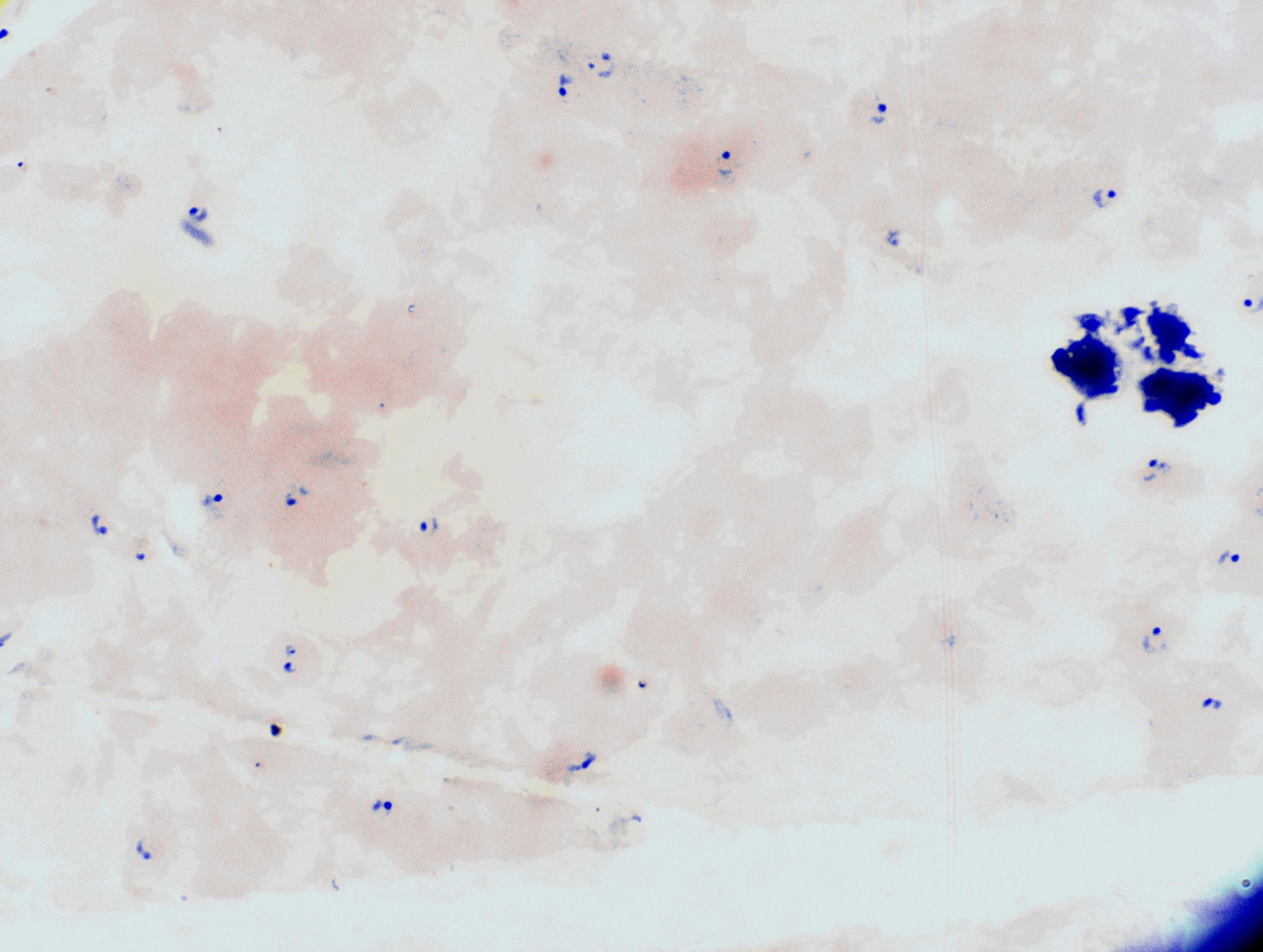 parasite_detectorv6 Object Detection Dataset by carnegie mellon university