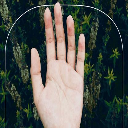 palmmm Object Detection Model by DT