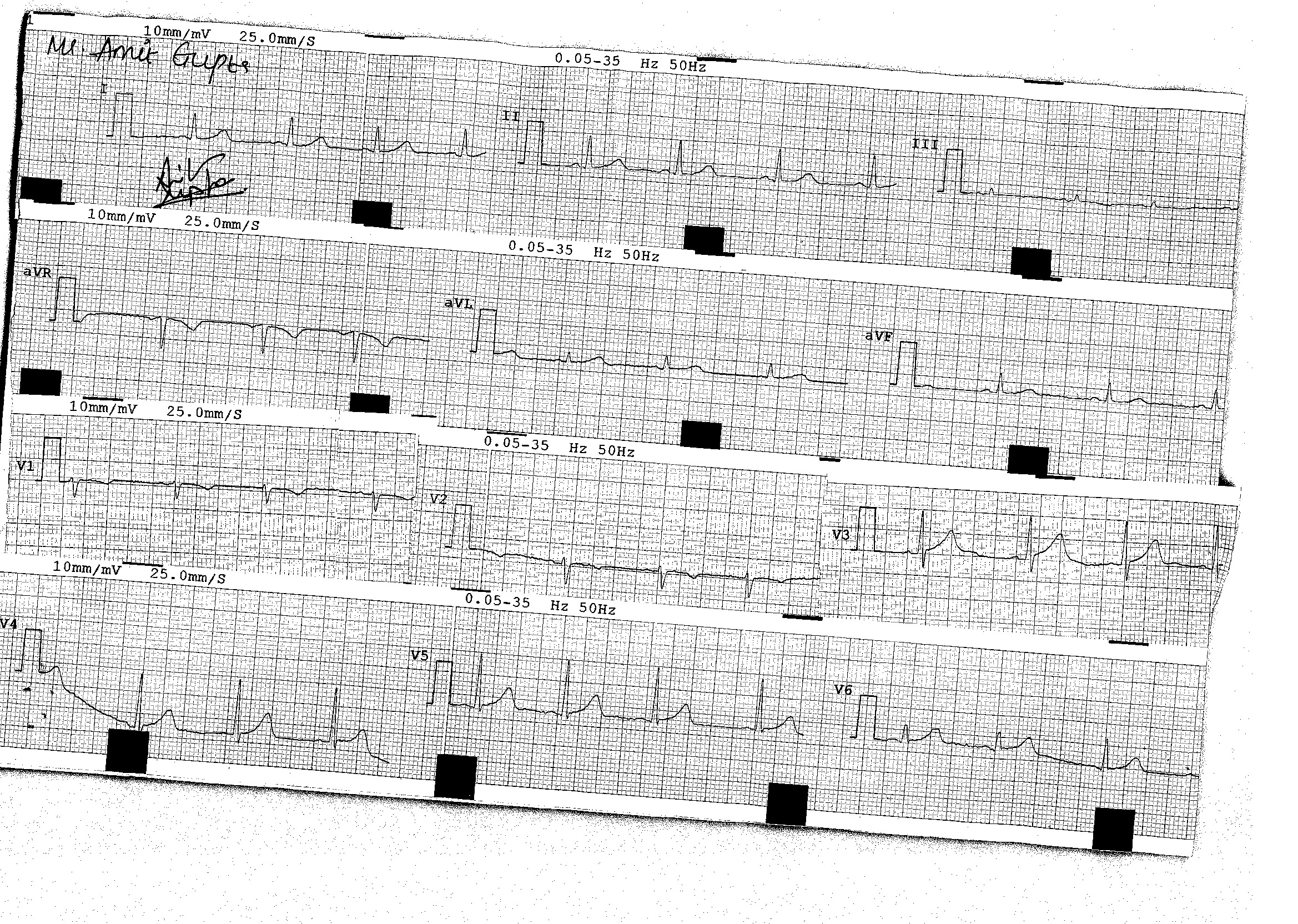 ECG_Final_2 Object Detection Dataset by ECGArtivatic