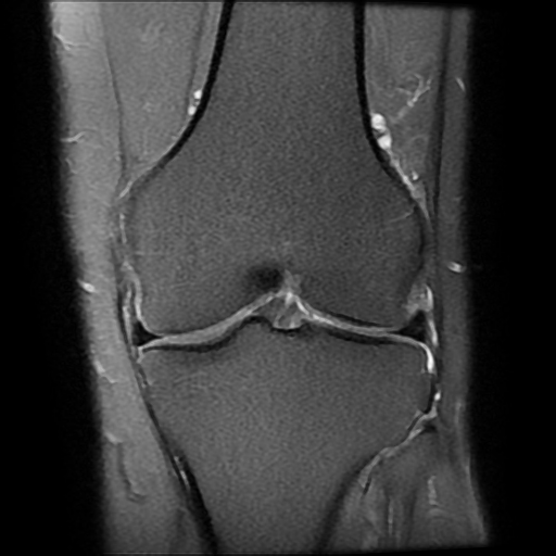 LCL Object Detection Dataset by hack