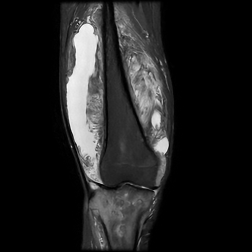 LCL_0_Grade Object Detection Dataset by hack