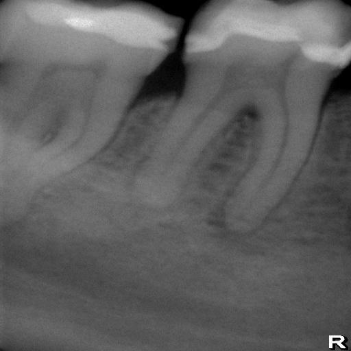cv_train Object Detection Dataset by tn2