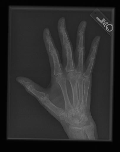 x-ray bones detector Object Detection Model by medical