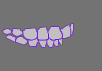 Tooth Detection (tooth-detection-9ayo9) - Roboflow Universe