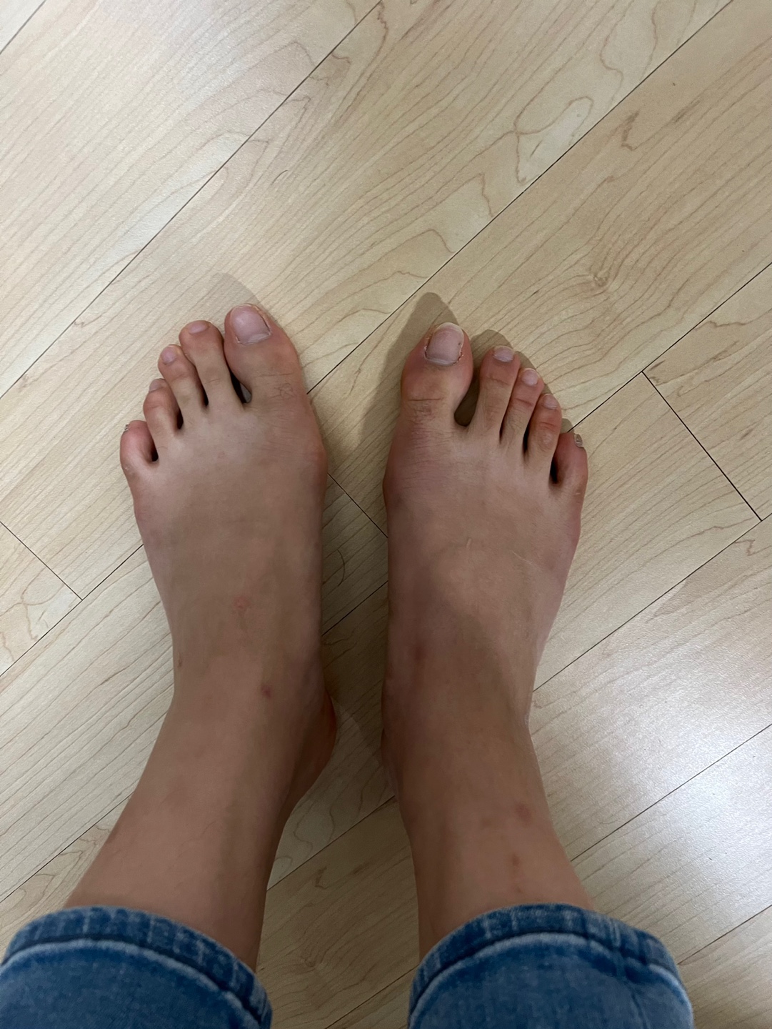 Foot Detection Object Detection Dataset And Pre Trained Model By