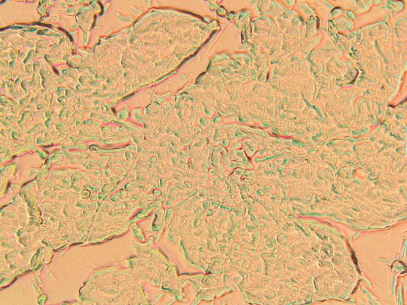 cancer detection Object Detection Model by Bionanophotonics