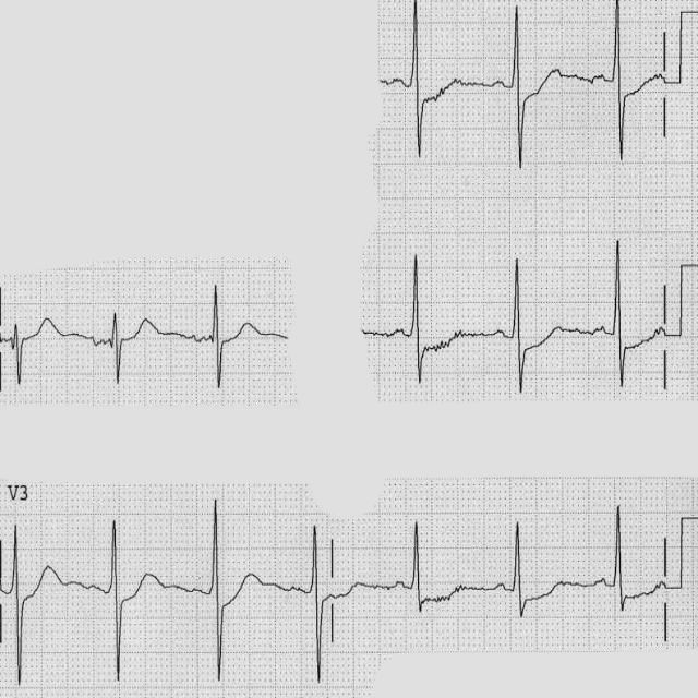 ecg_labeled_Marzo Object Detection Model by centro oncolgico integral