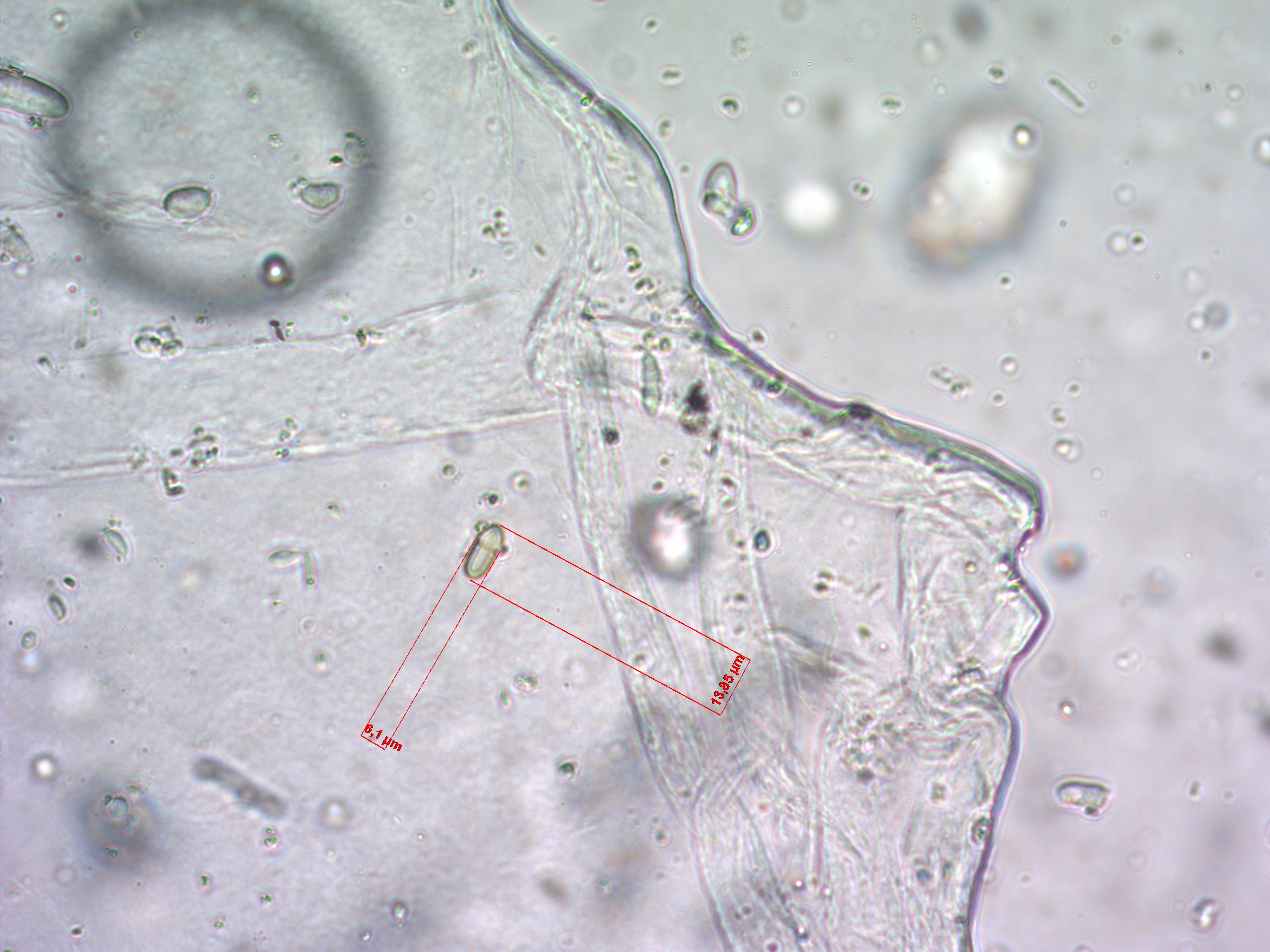 Spores part 2 Object Detection Dataset by Grzybsony