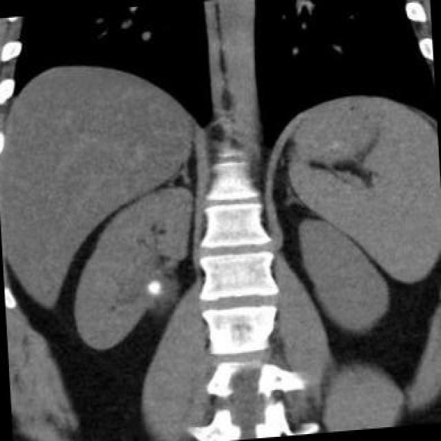 auto_radio Object Detection Dataset by gogogog