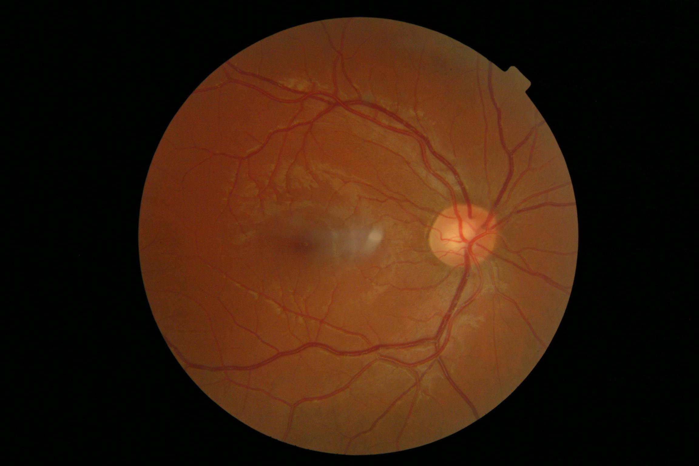 RD_Triage Classification Dataset by Lucas Zago